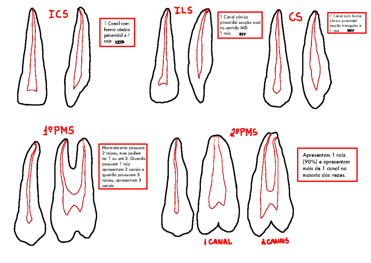 Trabalho Endodontia - Anatomia dos canais radiculares - 1 Canal com ...