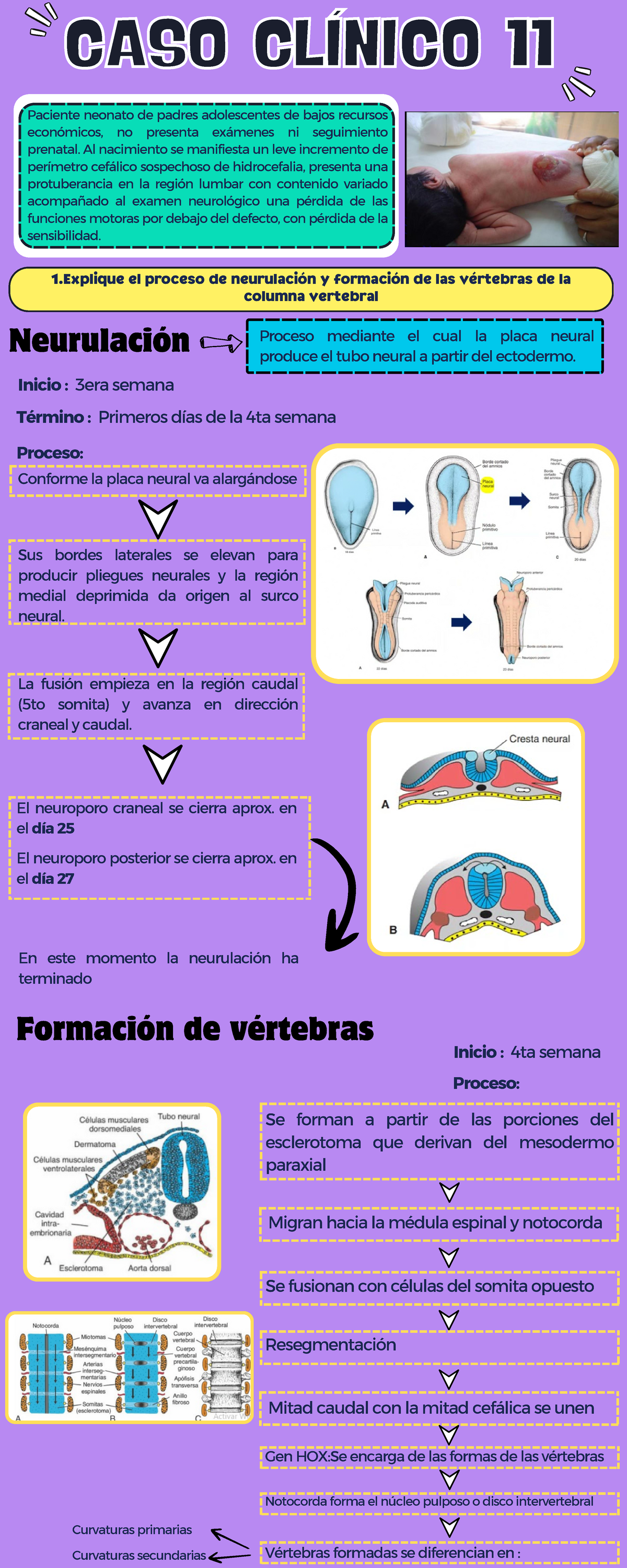 Infografía 11 - Embriología - 1 el proceso de neurulación y formación ...