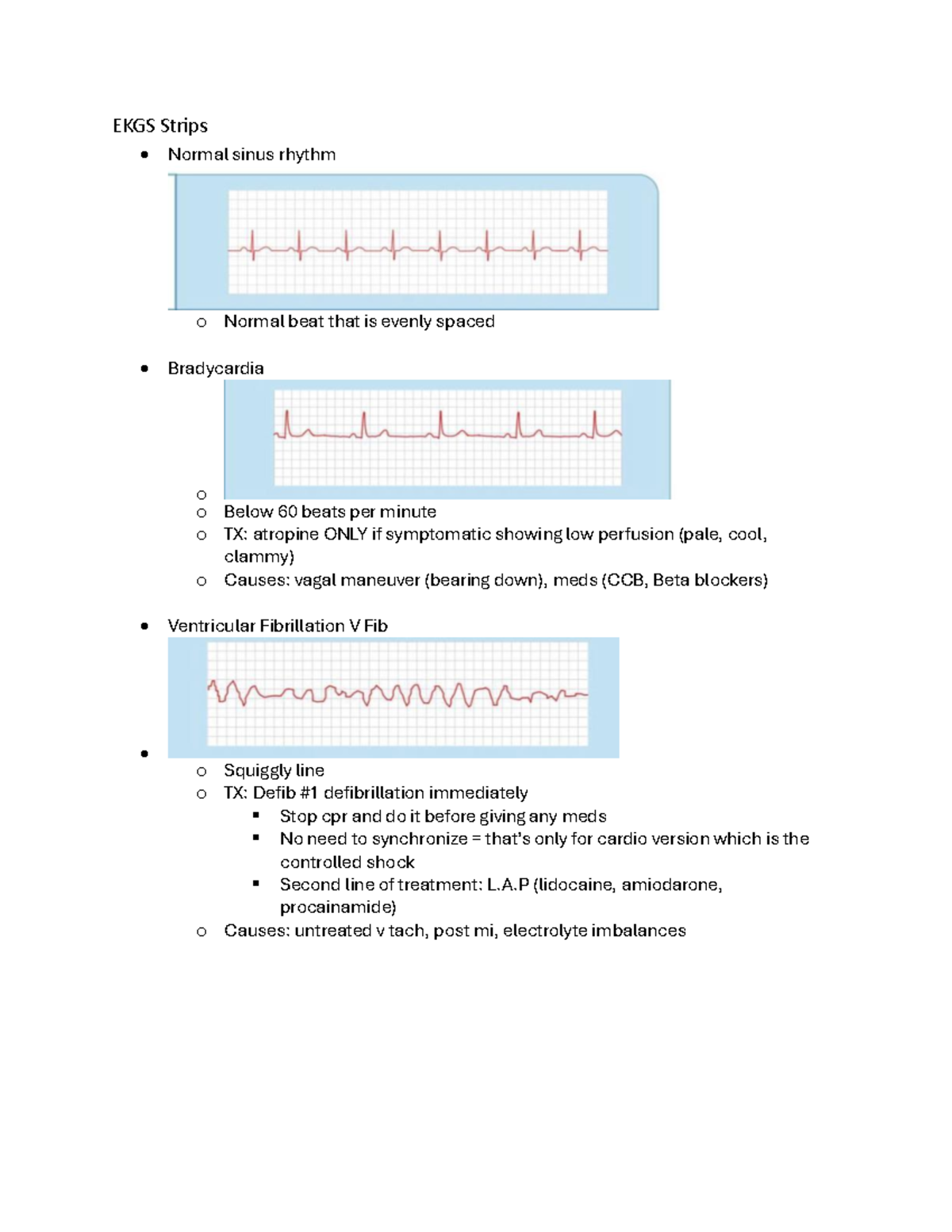 EKG simple nursing - EKGS Strips Normal sinus rhythm o Normal beat that ...