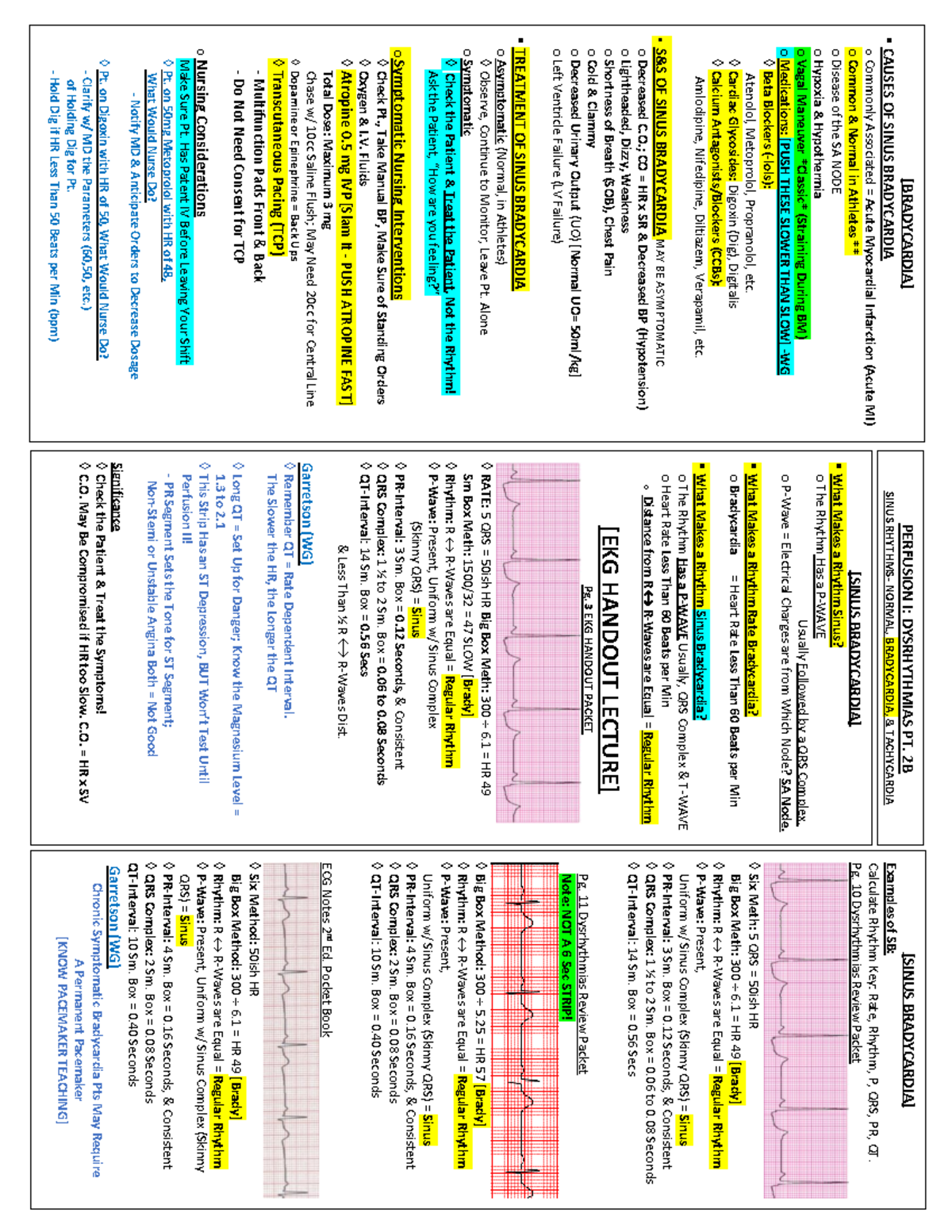 Perfusion I Dysrhythmias 2B - [SINUS BRADYCARDIA] o What Makes a Rhythm ...
