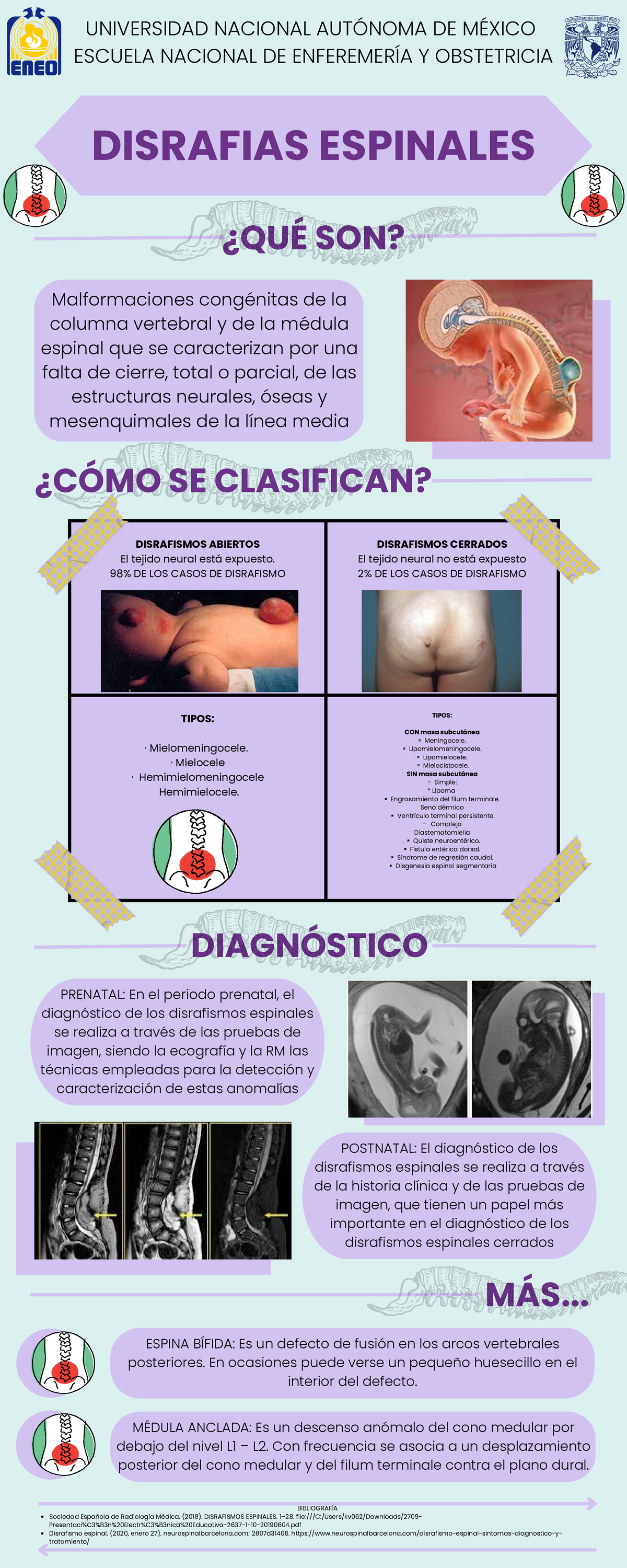 INF. Disrafias Espinales - DISRAFIAS ESPINALES Malformaciones ...