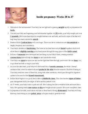 Shaken Baby assignment - SHAKEN BABY SYNDROME Directions: Complete the ...