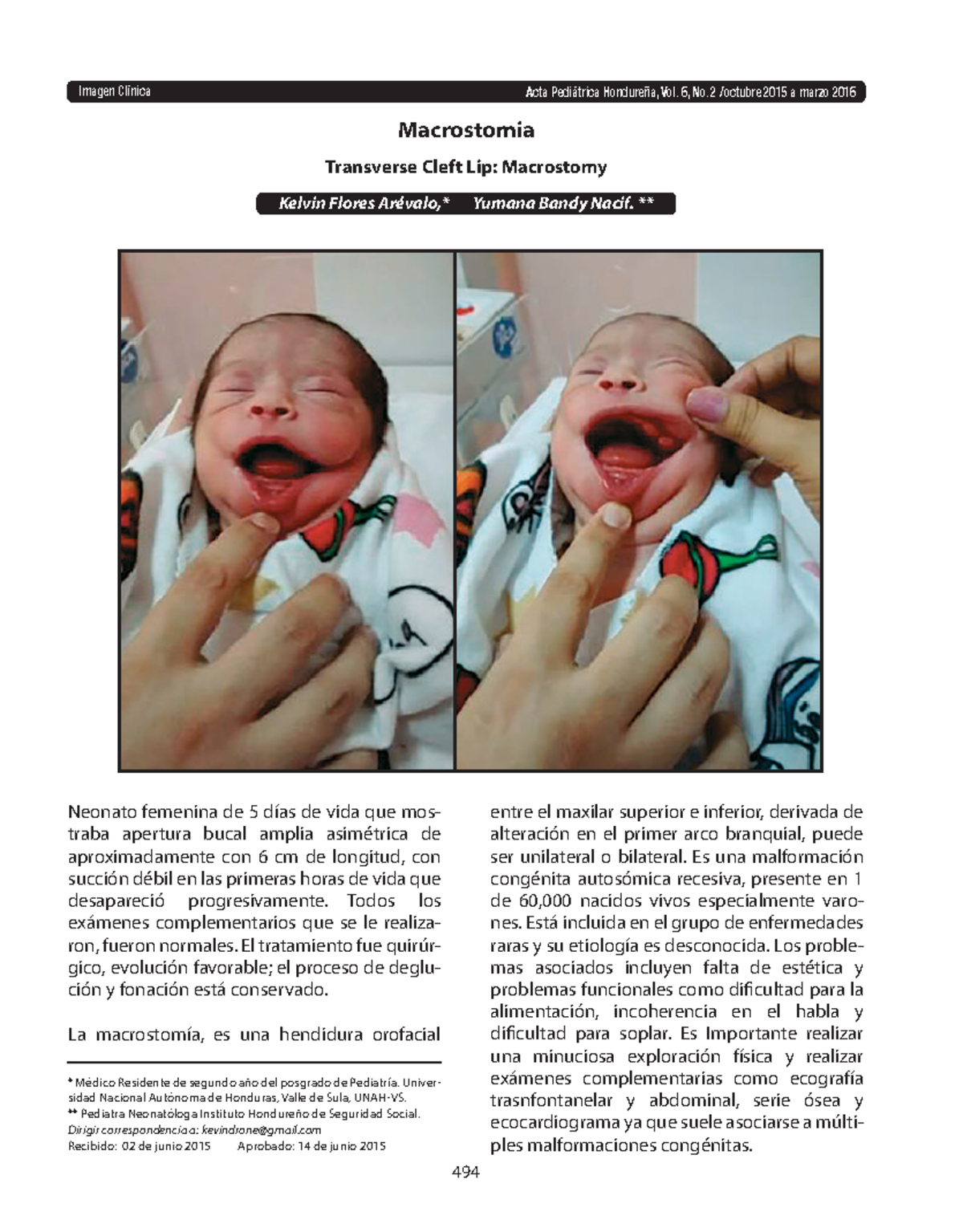 Macrostomía del primer arco - 494 Médico Residente de segundo año del ...