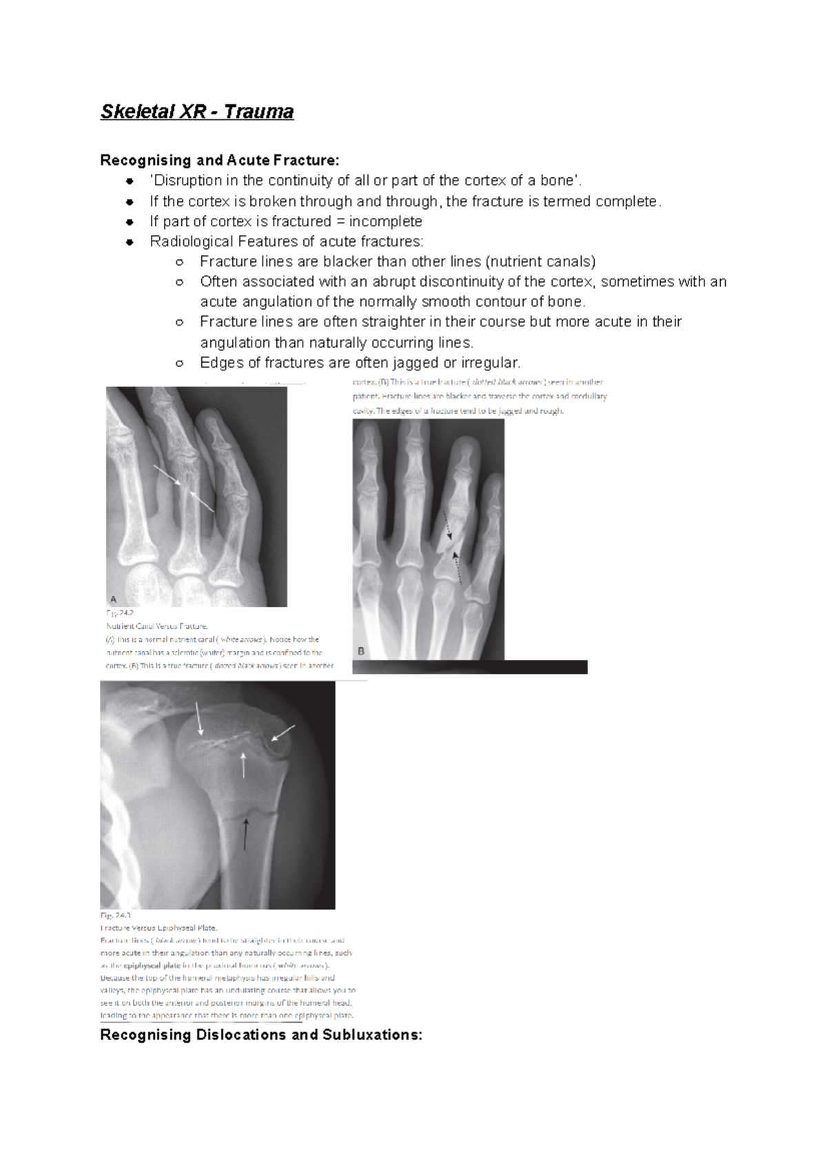 Skeletal XR - Trauma - Lecture notes Year 4 Radiology - Skeletal XR ...