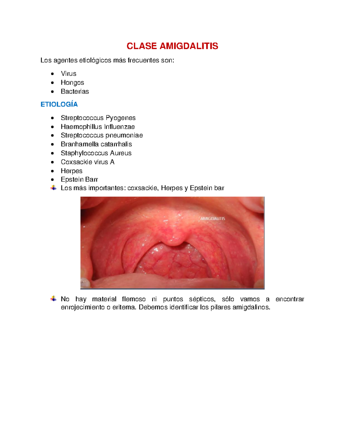 Clase Amigdalitis - CLASE AMIGDALITIS Los agentes etiológicos más ...
