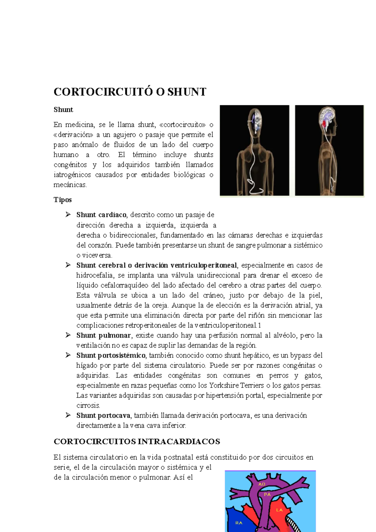 Anatomia Patologica - LLLLLLL - CORTOCIRCUITÓ O SHUNT Shunt En medicina ...