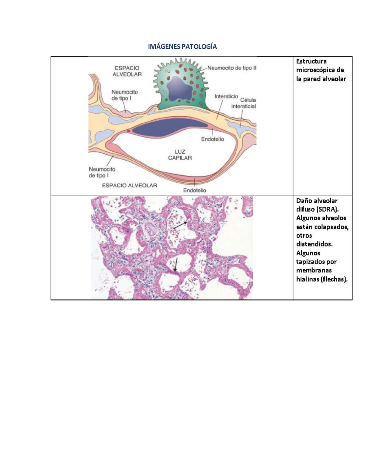 IMÁ Genes PatologíA - Guias sobre todo el parcial de patologia ...