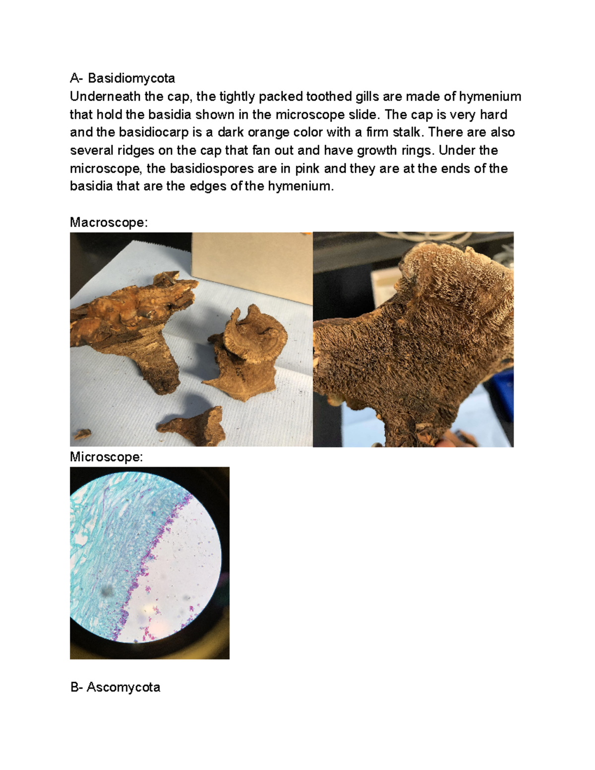 Fungal Classification - A- Basidiomycota Underneath the cap, the ...