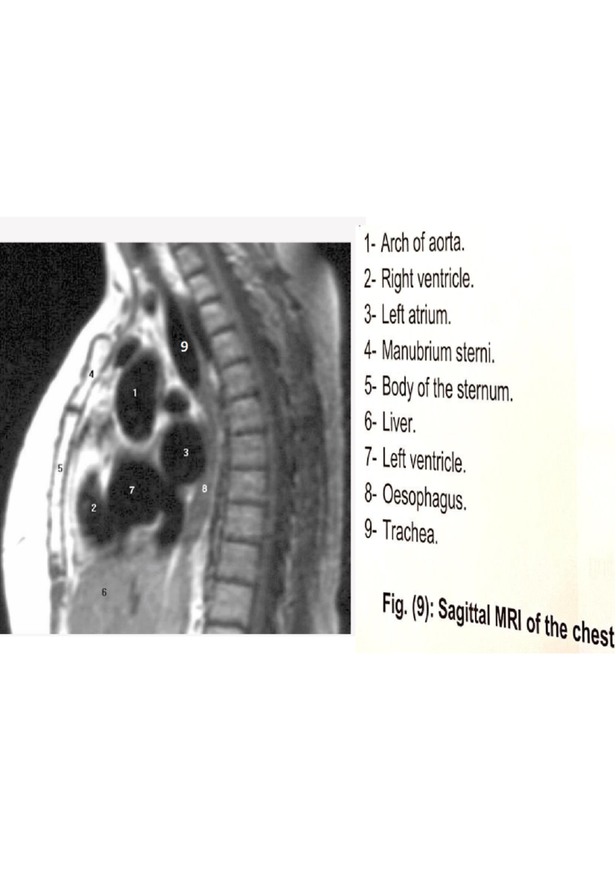 9 of x-ray 🩻 file - Summary X-Ray Diffraction Crystallography Introduction, Examples and Solved ...