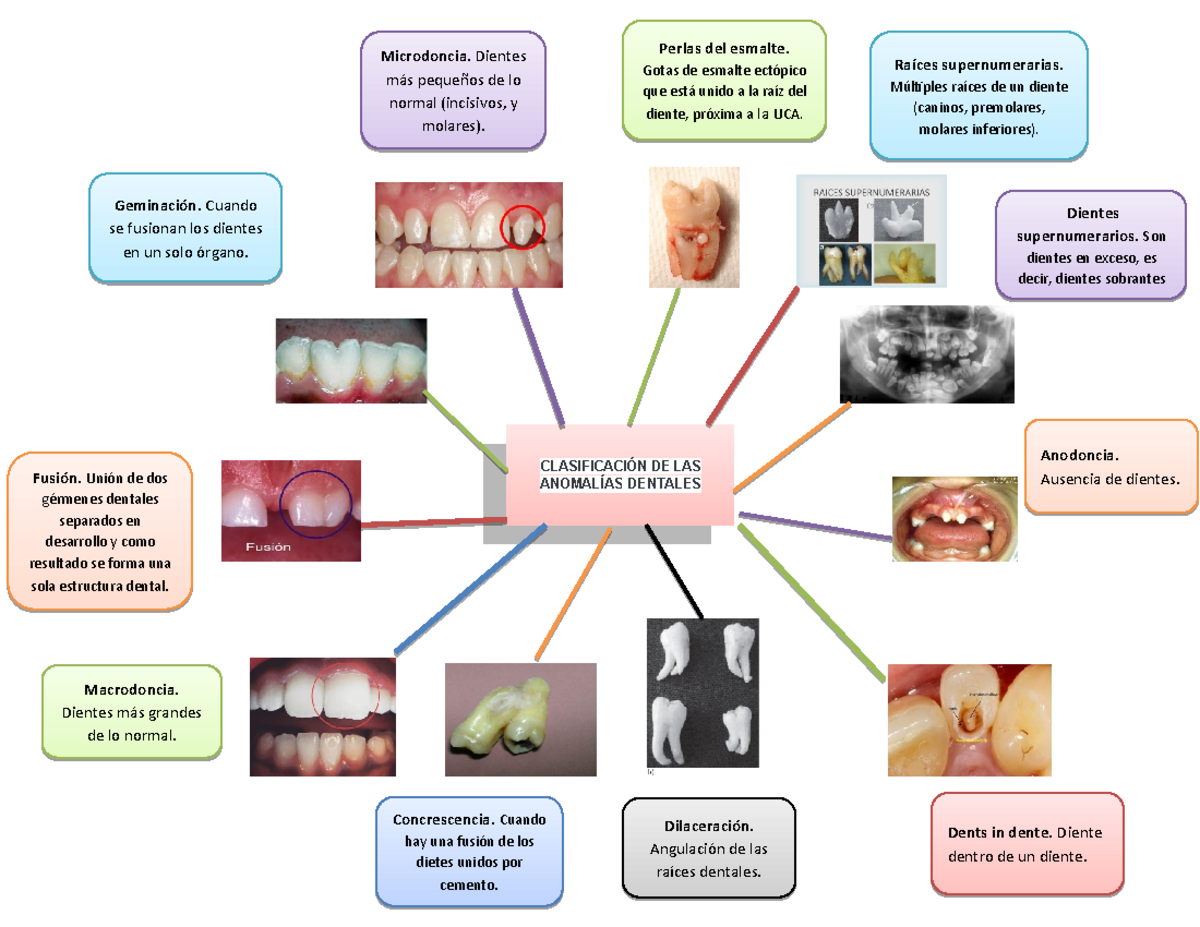 MAPA Mental Anomalias Dentales - Microdoncia. Dientes más pequeños de ...