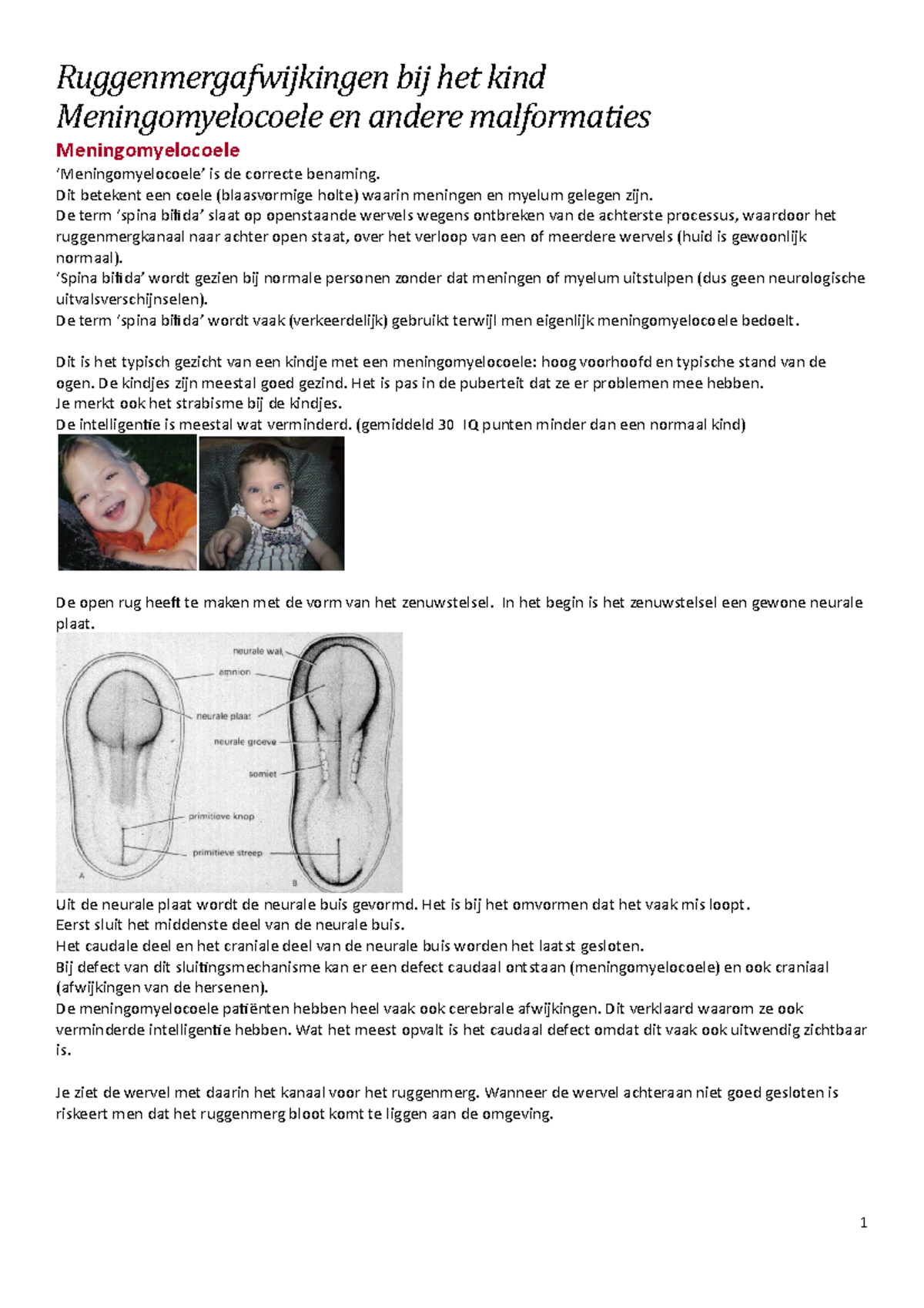 Ruggenmergafwijkingen - Dit betekent een coele (blaasvormige holte ...