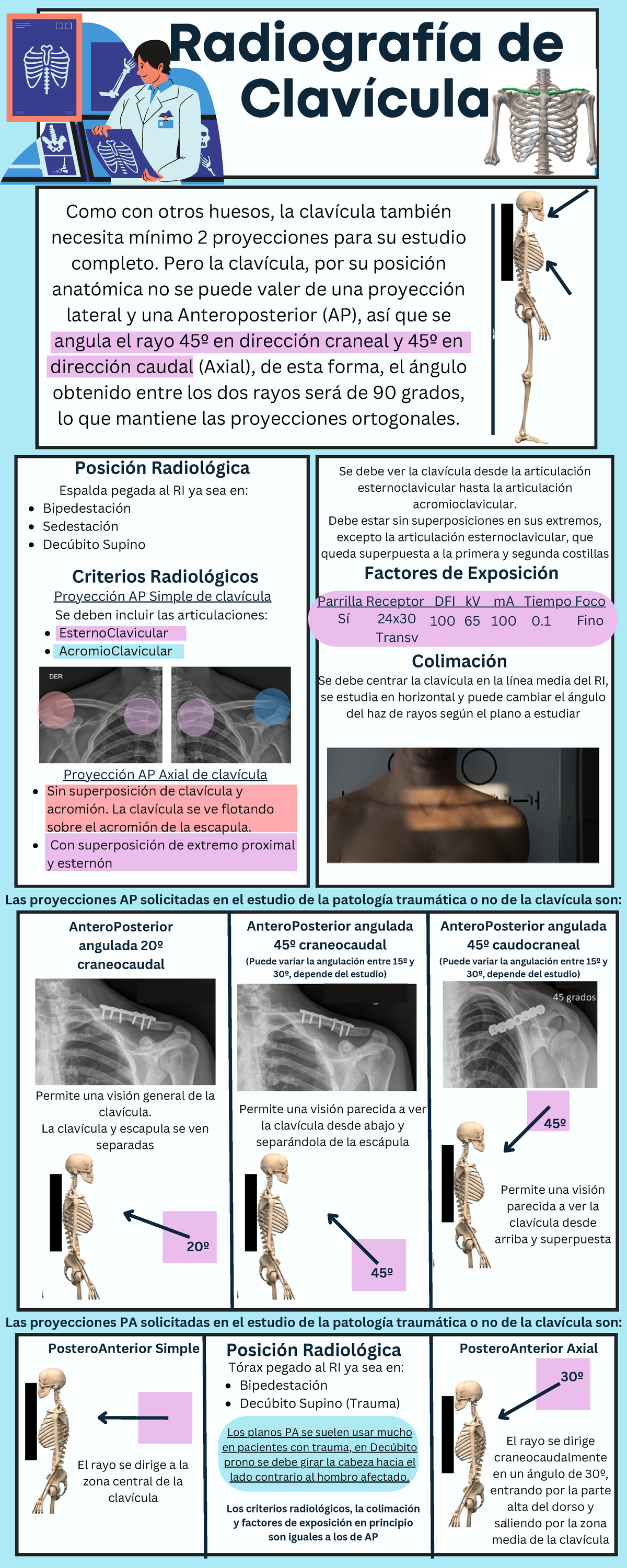 Radiografía DE Clavícula 20240418 002555 0000 - Permite una visión ...