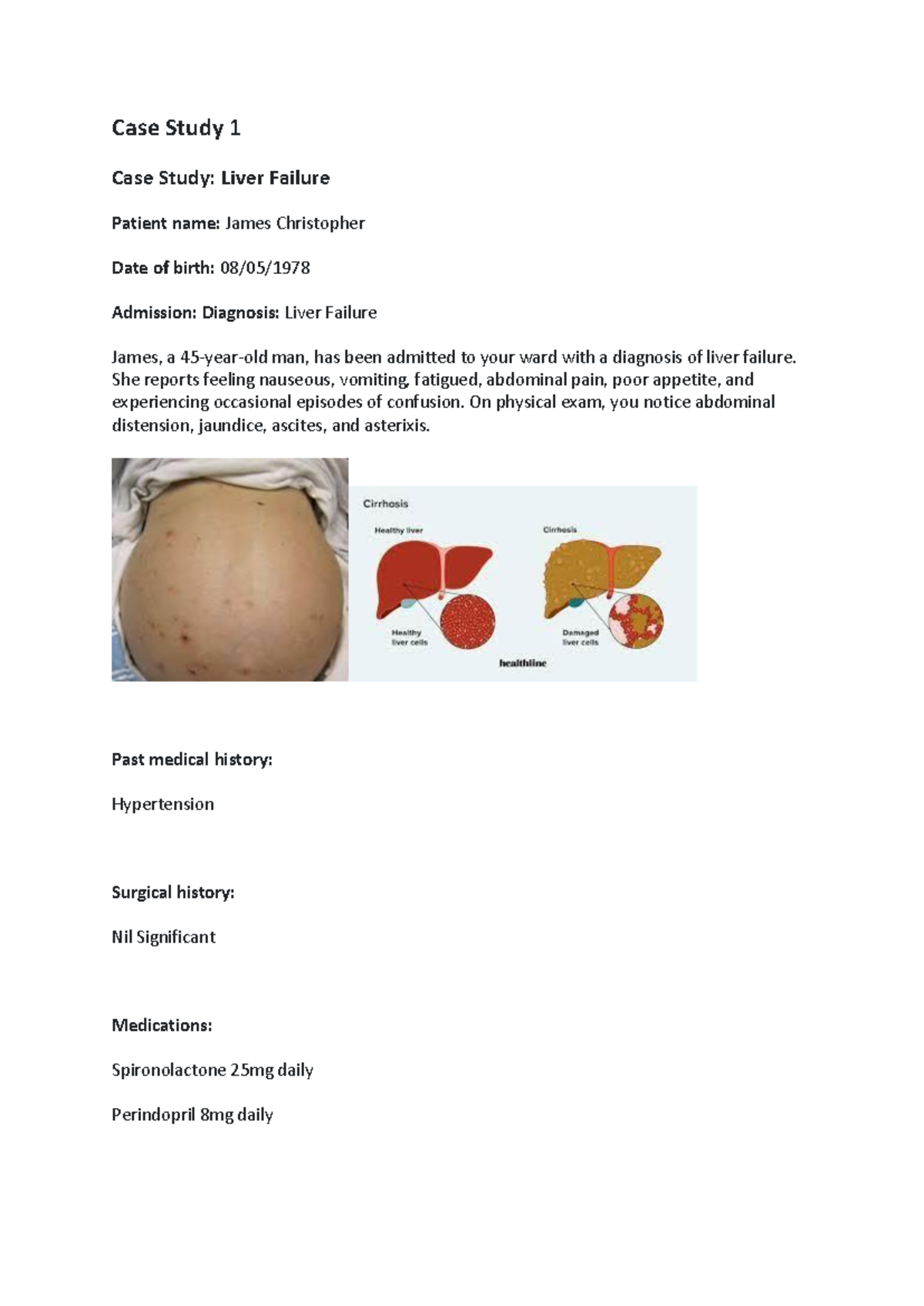 NURS1002 Case study Liver Failure and Congestive cardiac Failure-1 - Case Study 1 Case Study ...