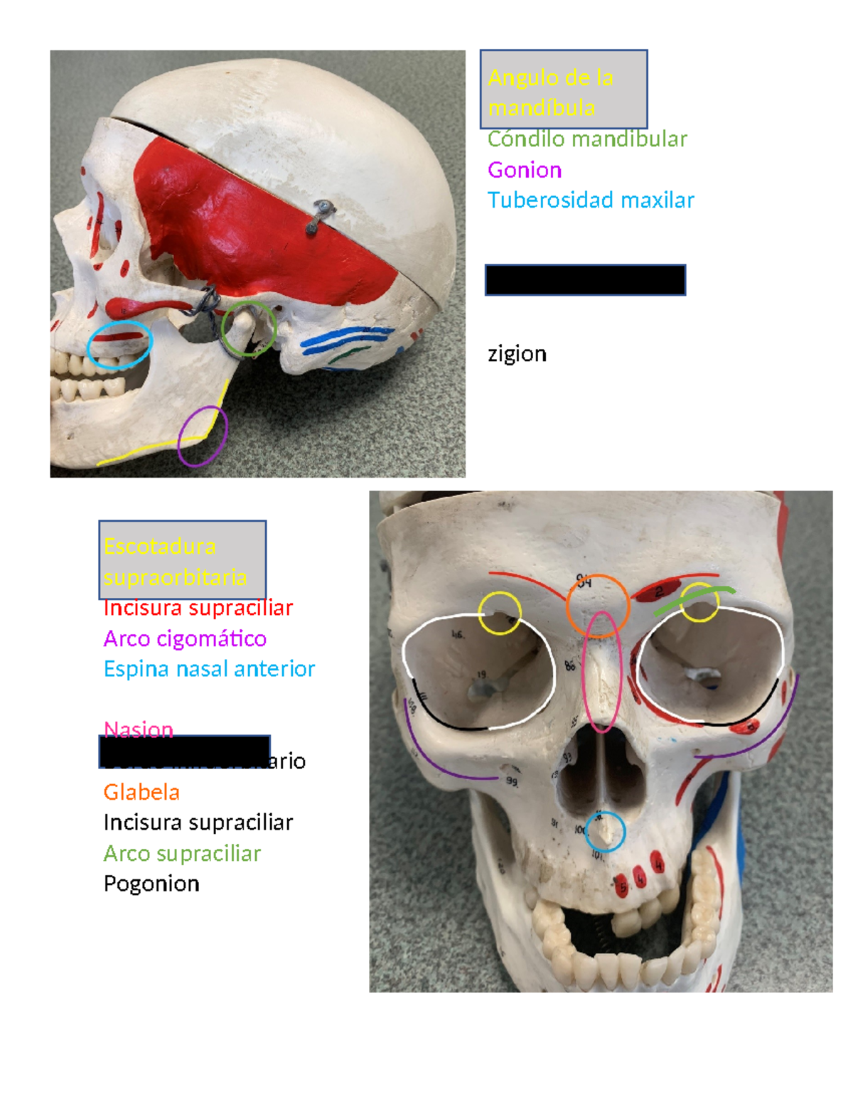 Anatomia 90 huesos - detalles óseos - Angulo de la mandíbula Cóndilo ...