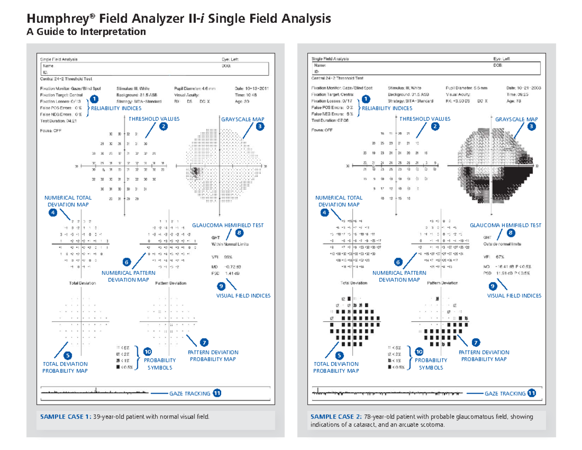 How to read an HFA SFA Report HFA5268 SEC - Humphrey ® Field Analyzer ...