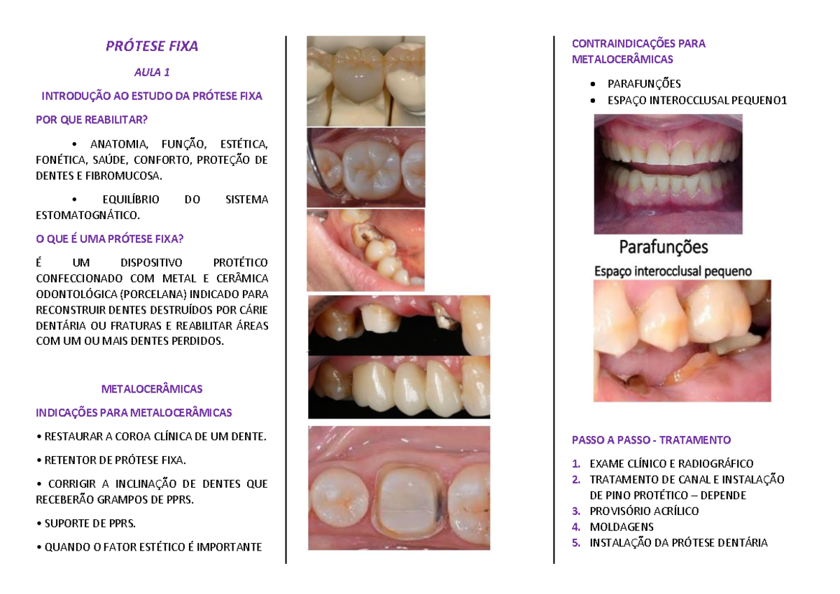 Resumo PF Oficial - PRÓTESE FIXA AULA 1 INTRODUÇÃO AO ESTUDO DA PRÓTESE ...
