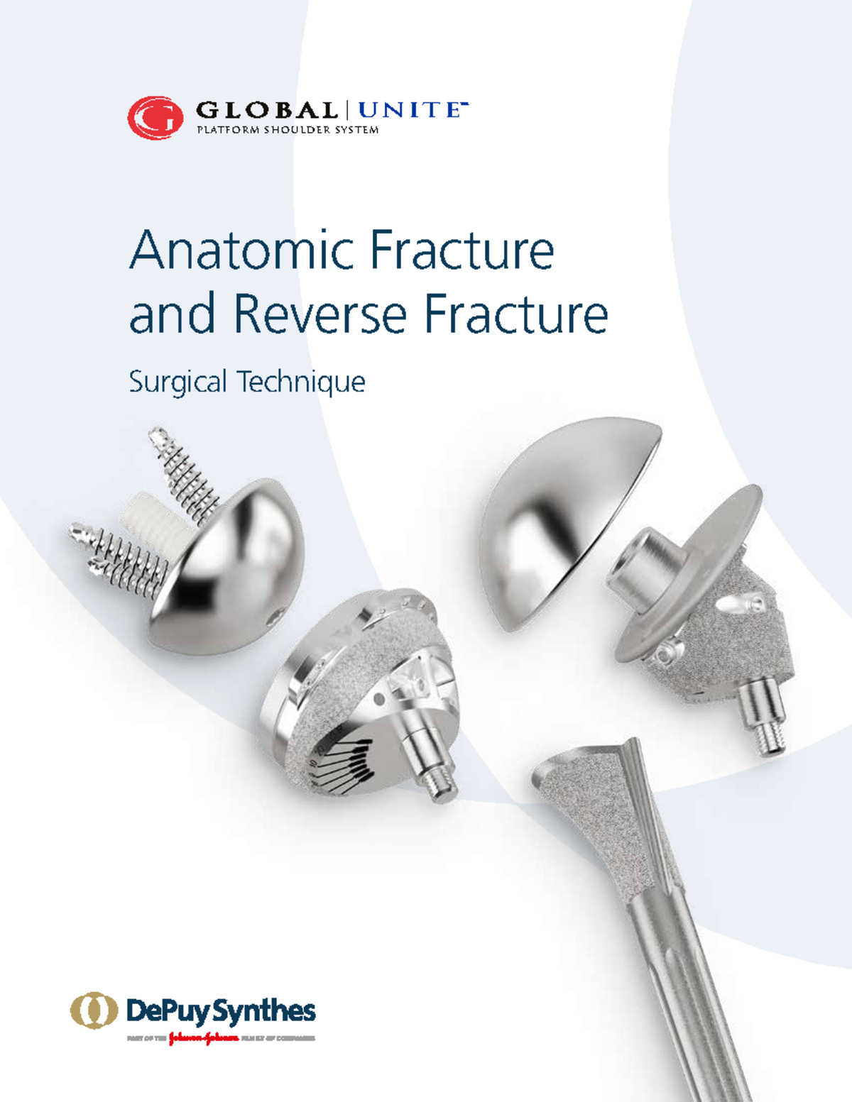 Global Unite PTH anatomica e invertida - Anatomic Fracture and Reverse ...
