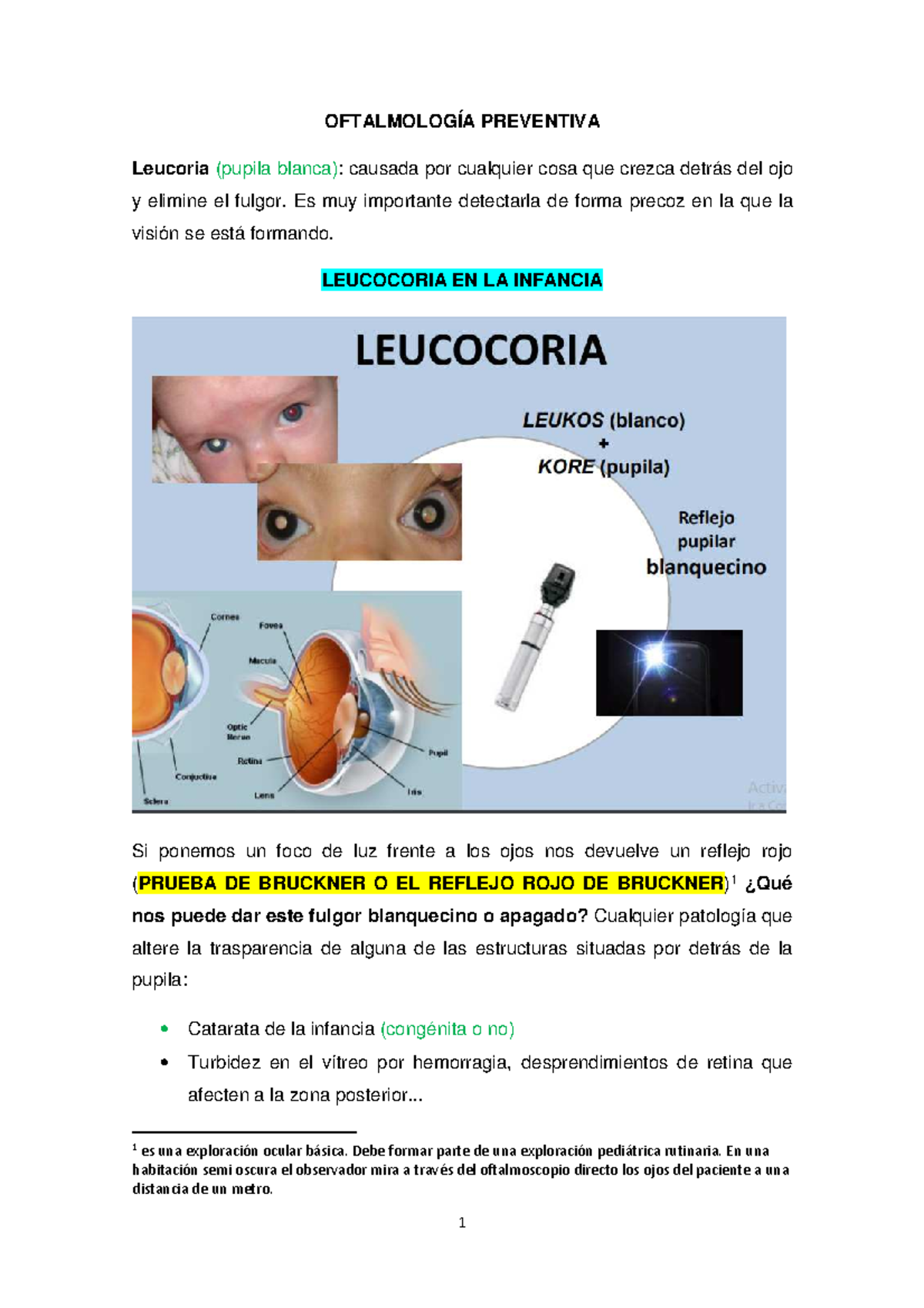 Leucocoria Infantil - Apuntes Resumen - OFTALMOLOGÍA PREVENTIVA ...