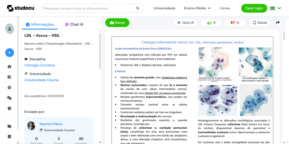 LSIL - Ascus - HSIL - Citologia Inflamatória ( Ascus, LSIL, HSIL ...
