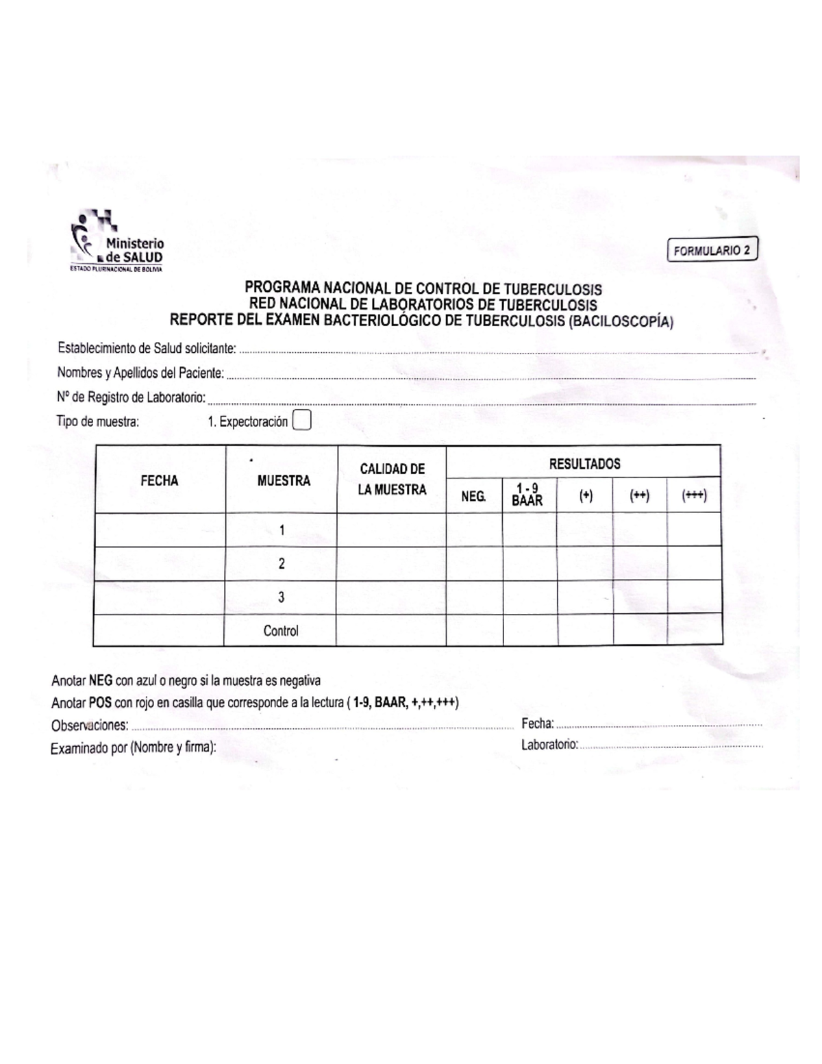Tuberculosis pulmonar - Investigación II (Epidemiología) - Studocu