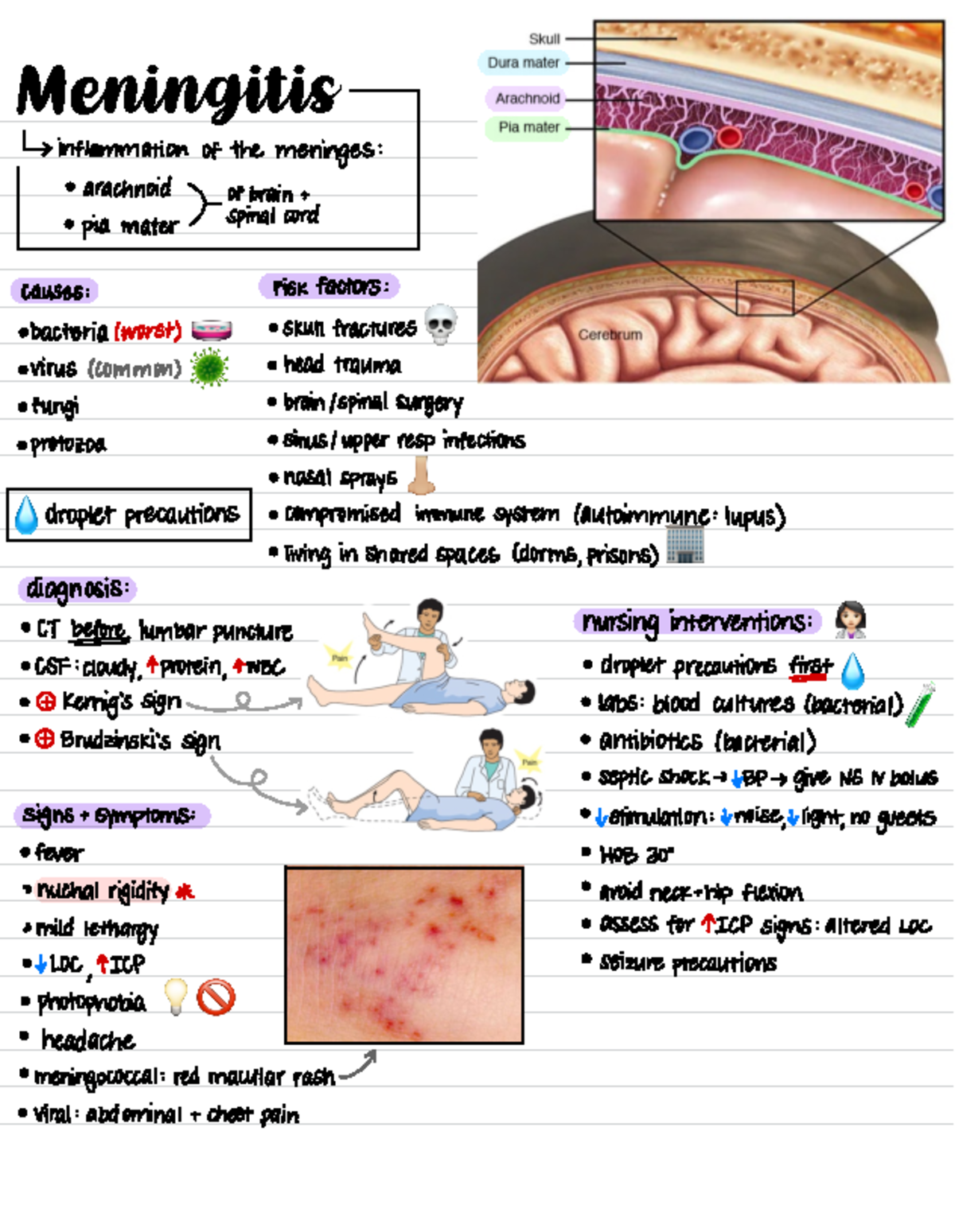 Meningitis - Studocu