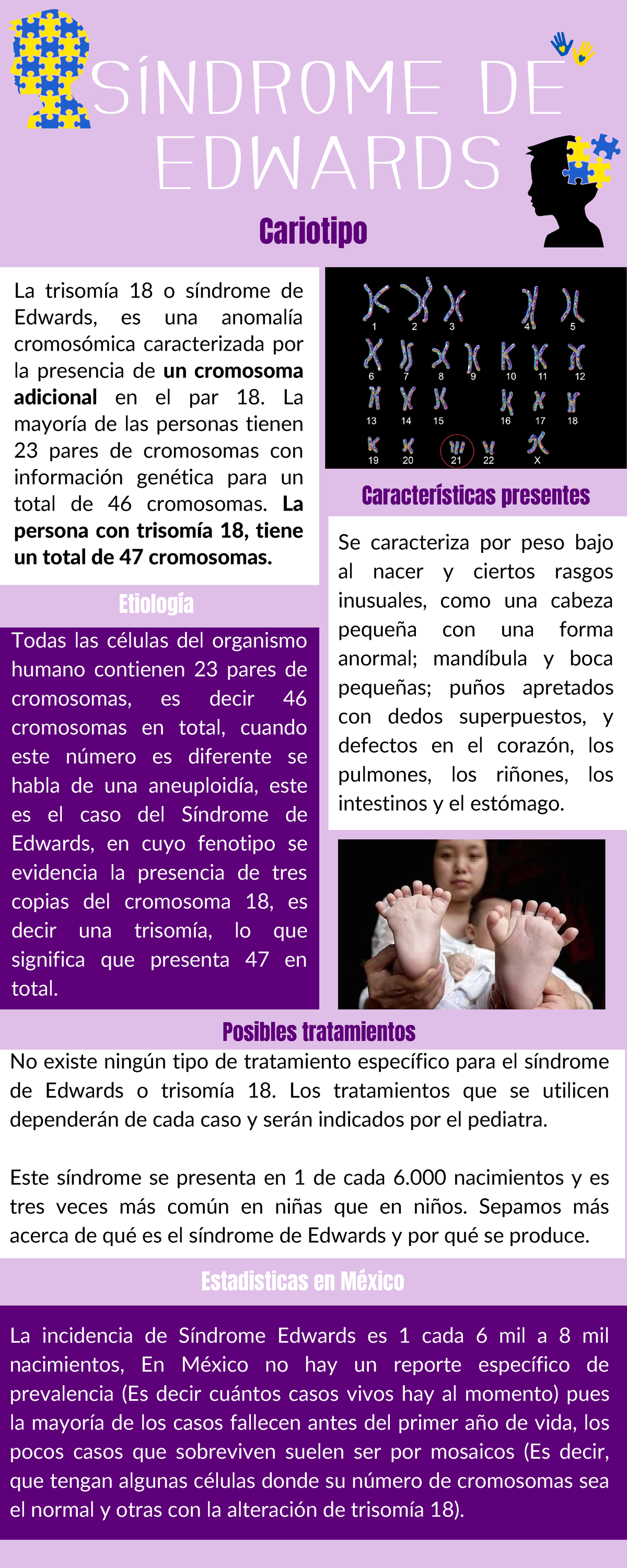 Infografía del síndrome de Edwards - La trisomía 18 o síndrome de ...