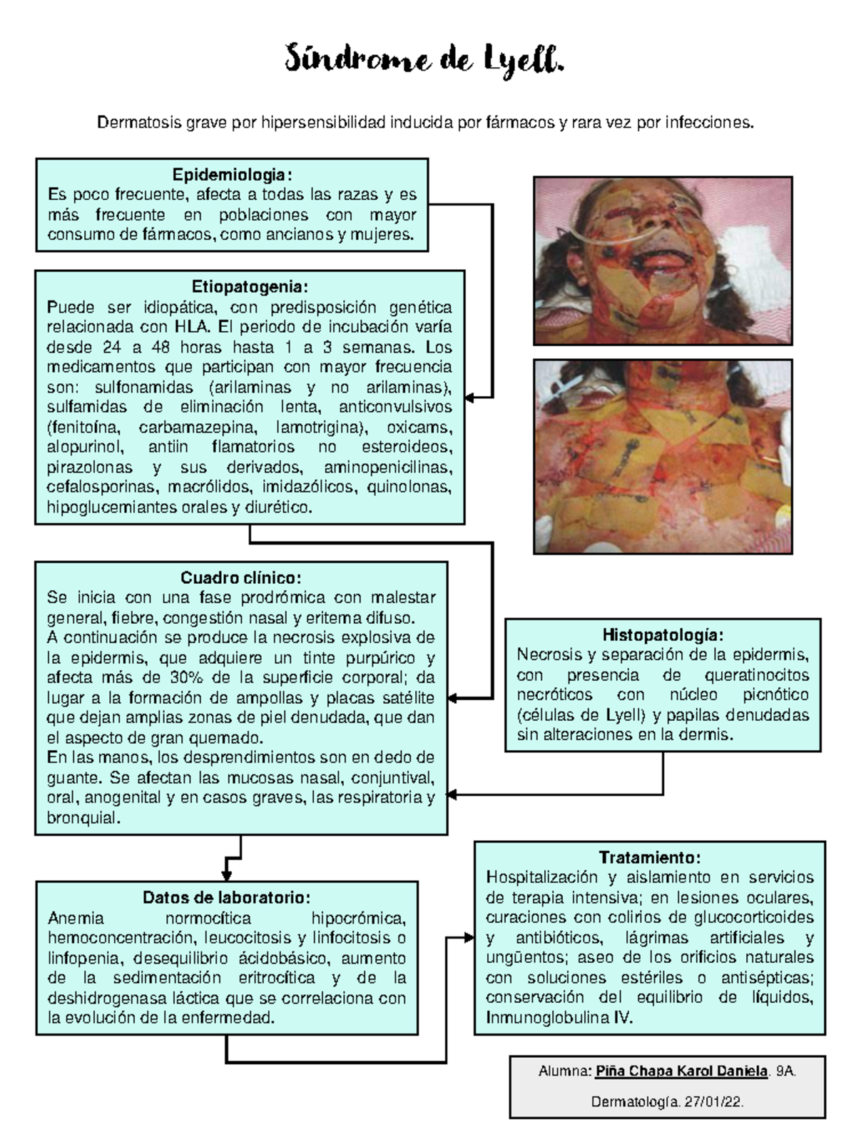 8 - Tarea del síndrome de Lyell - SÌndrome de Lyell. Alumna: Piña Chapa ...