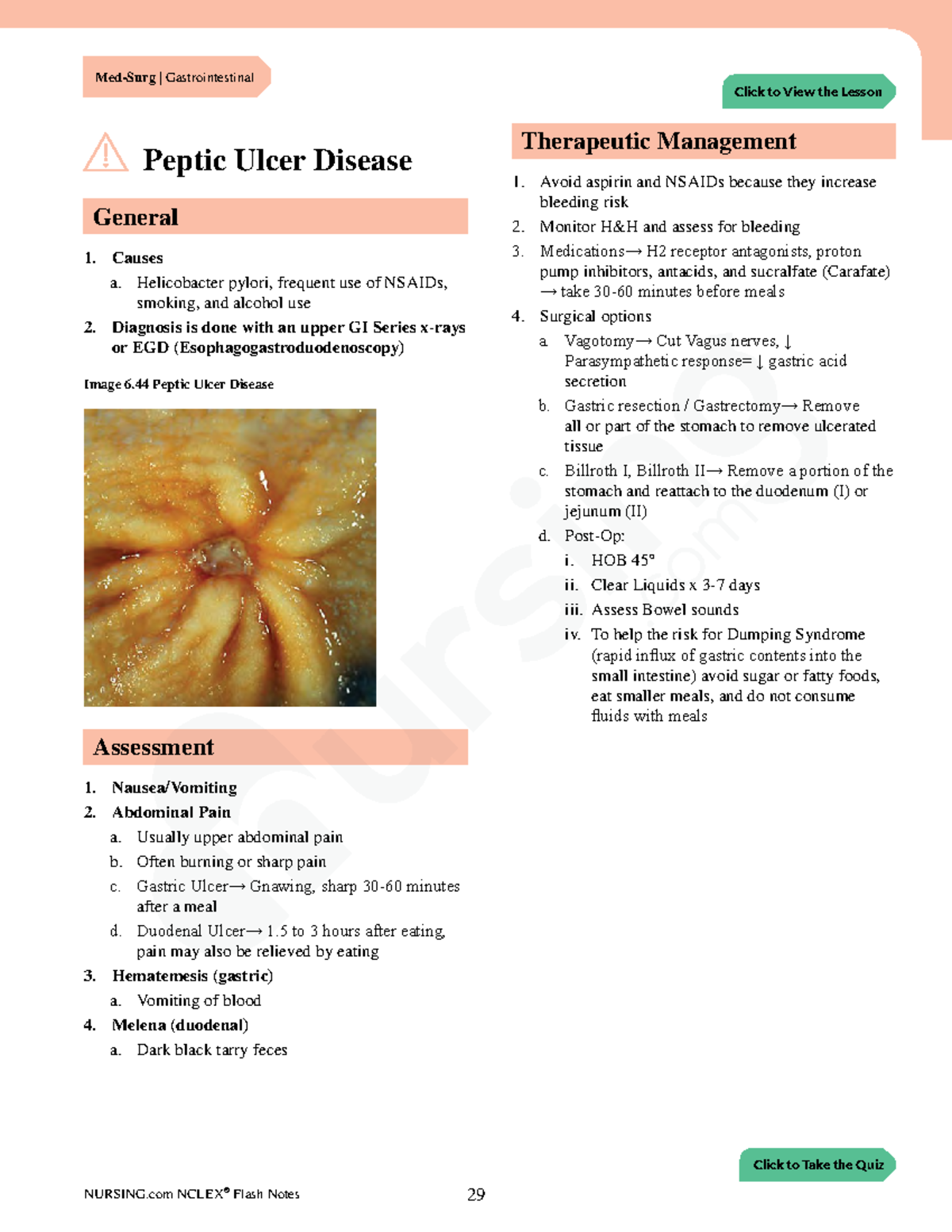 PUD Flash Card - NURSING NCLEX ® Flash Notes 29 Peptic Ulcer Disease ...