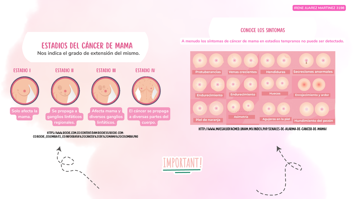 Hablemos de Cáncer de Mama. Irene Juárez Martínez - ESTADIOS DEL CÁNCER ...