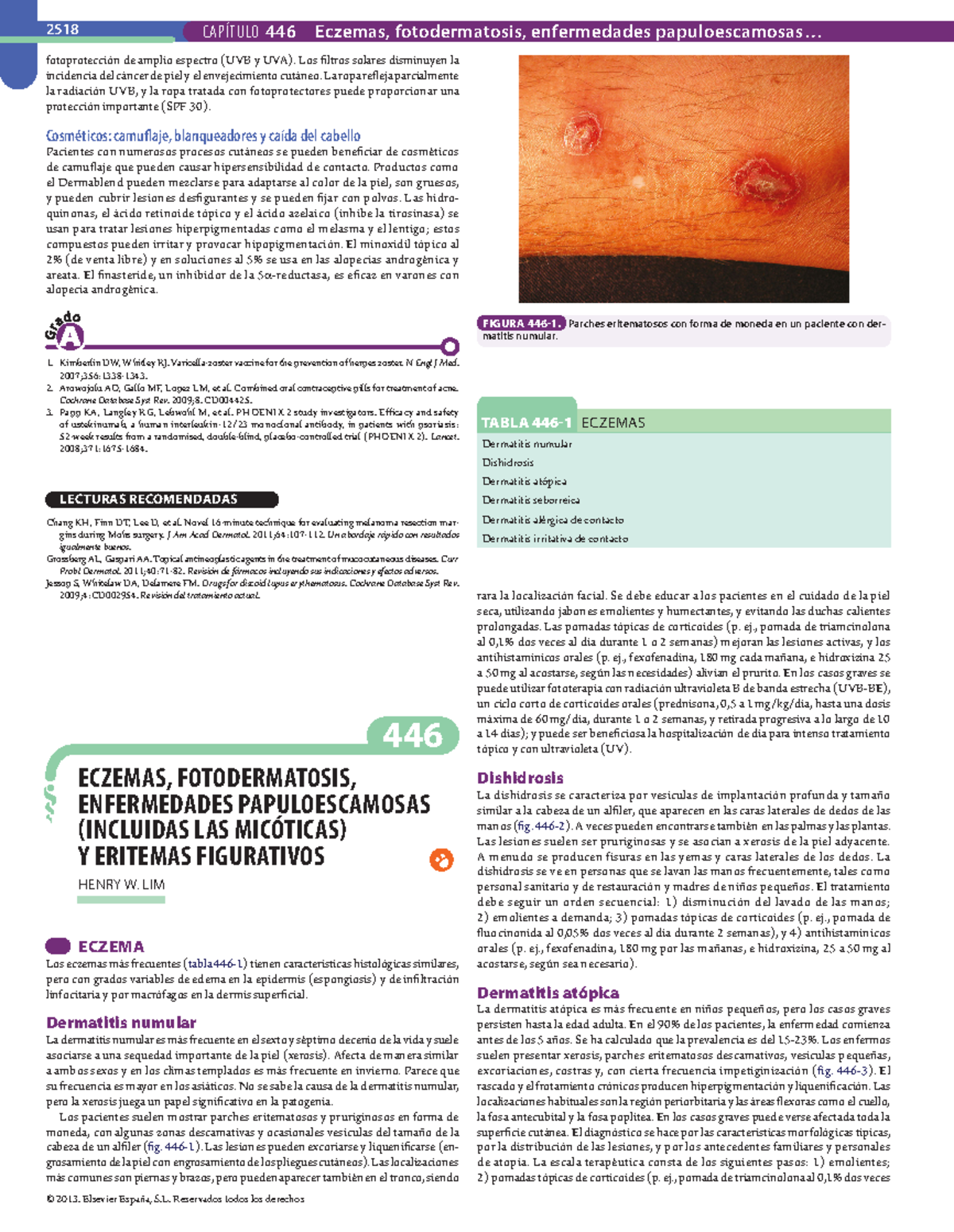 Cap. 446 Eczemas, fotodermatosis, enfermedades papuloescamosas ...