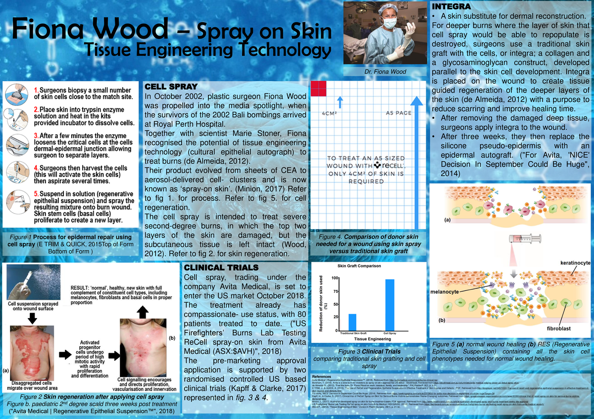 1014MSC Poster Final COPY - Fiona Wood – Spray on Skin Tissue ...