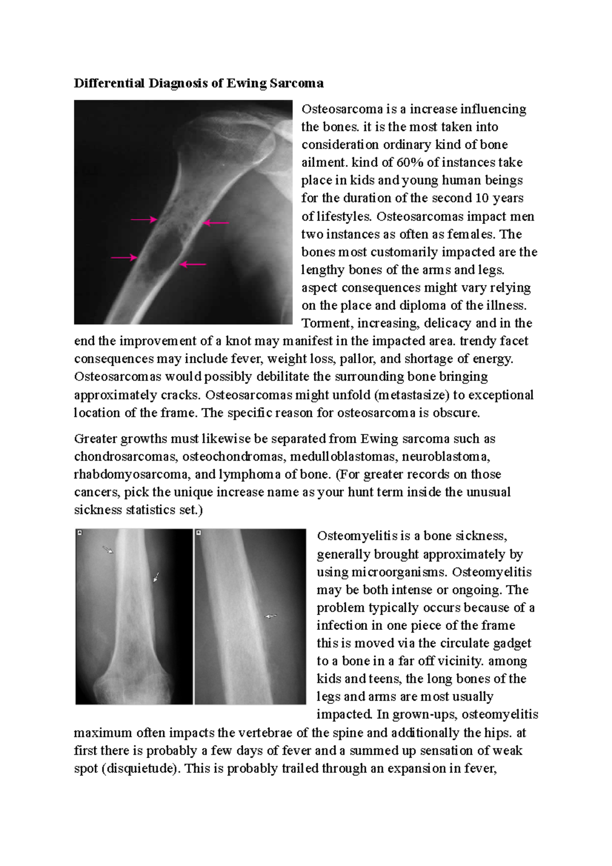Diagnosis of Ewing Sarcoma - Differential Diagnosis of Ewing Sarcoma Osteosarcoma is a increase ...