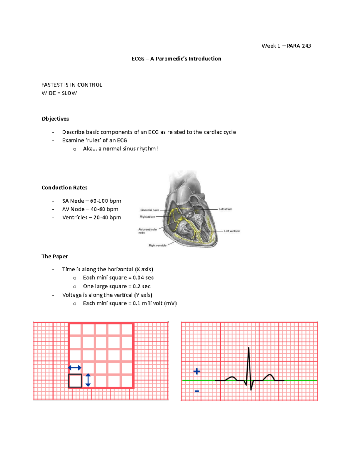 Week 1 ECG Intro - Week 1 lecture notes - Week 1 – PARA 243 ECGs – A ...
