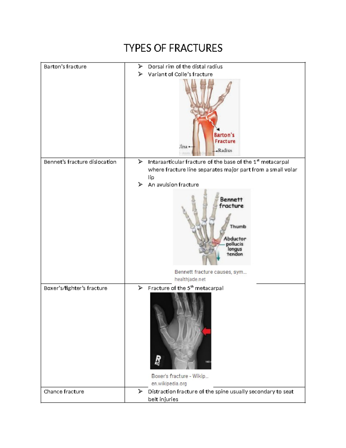 Types-OF- Fractures - Notes assignment and home work and exam for the ...