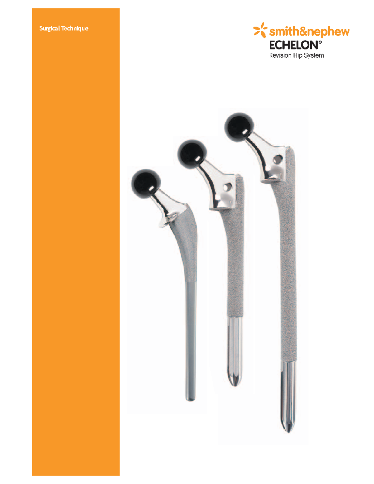 REC ST Echelon revision ingles para cadera de revision. - Surgical ...