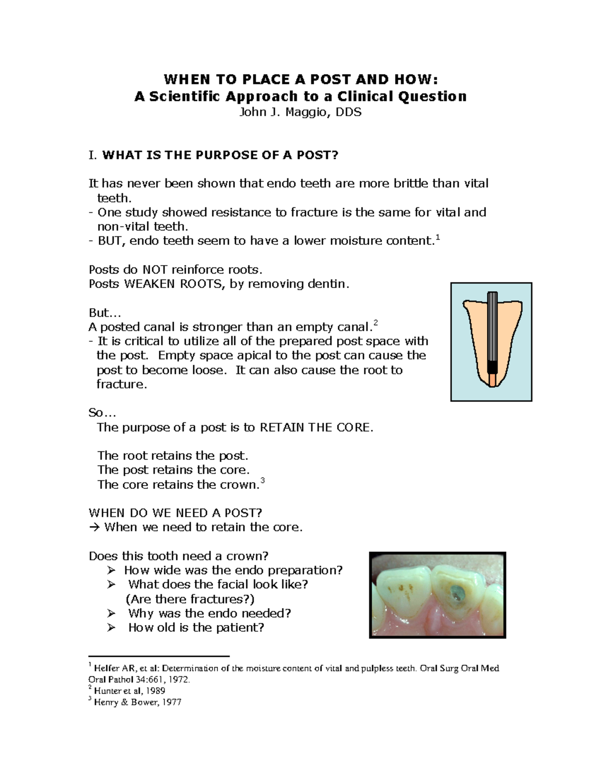 Post and core and its clinical approach - - Studocu