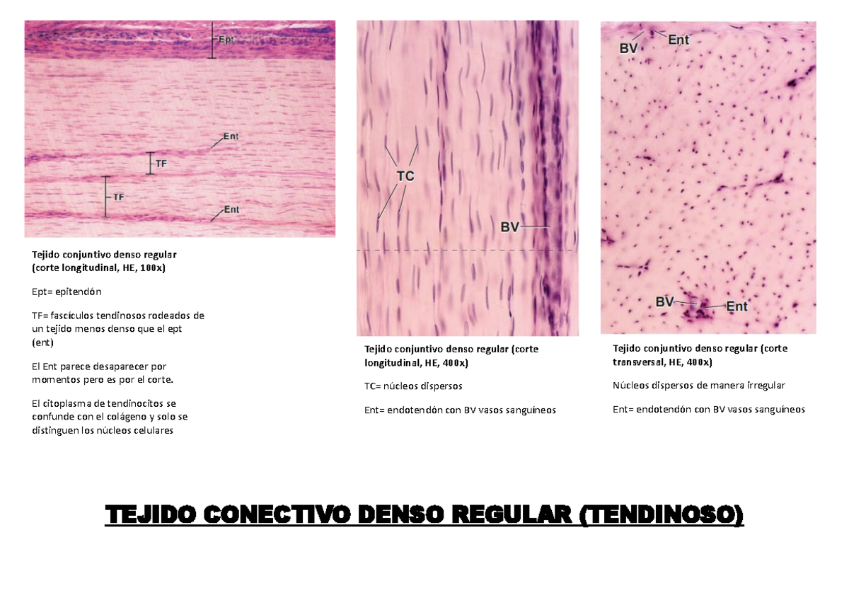 Flashcards Histo - TEJIDO CONECTIVO DENSO REGULAR (TENDINOSO) Tejido ...