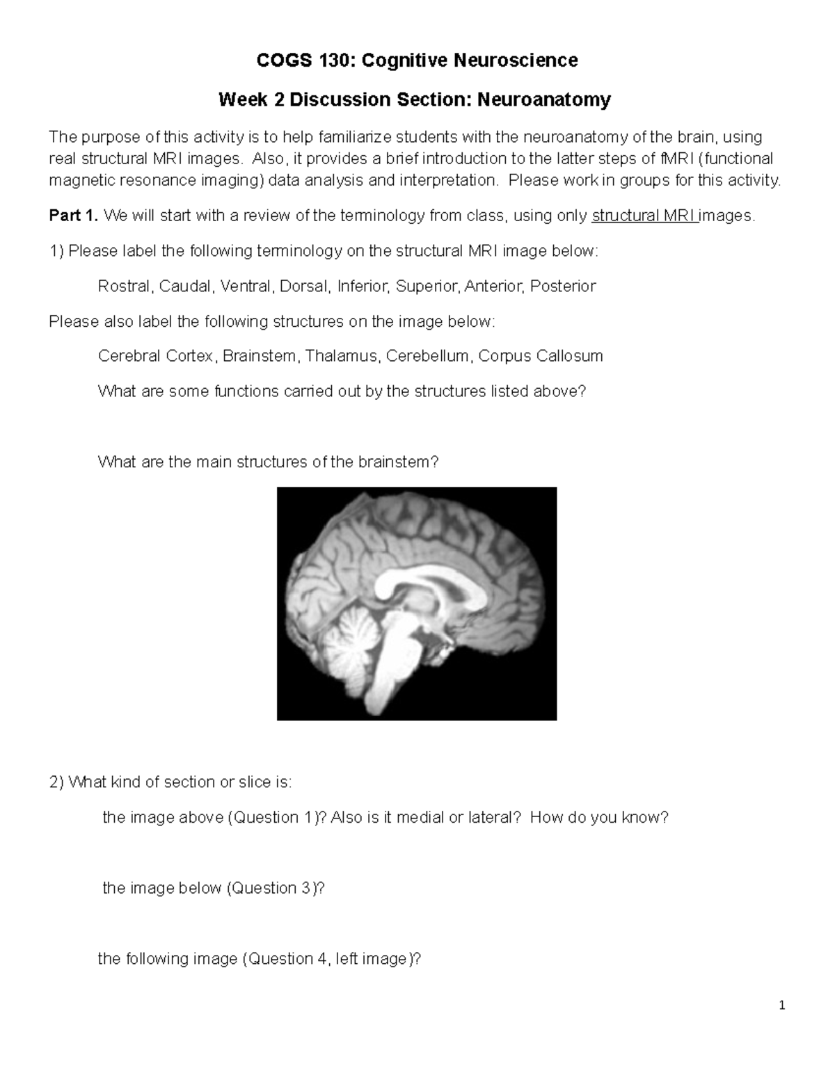 Week2 Neuro Anatomy Handout - COGS 130: Cognitive Neuroscience Week 2 ...