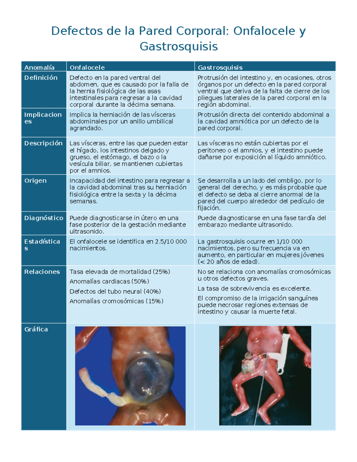 Onfalocele y Gastrosquisis - Defectos de la Pared Corporal: Onfalocele ...