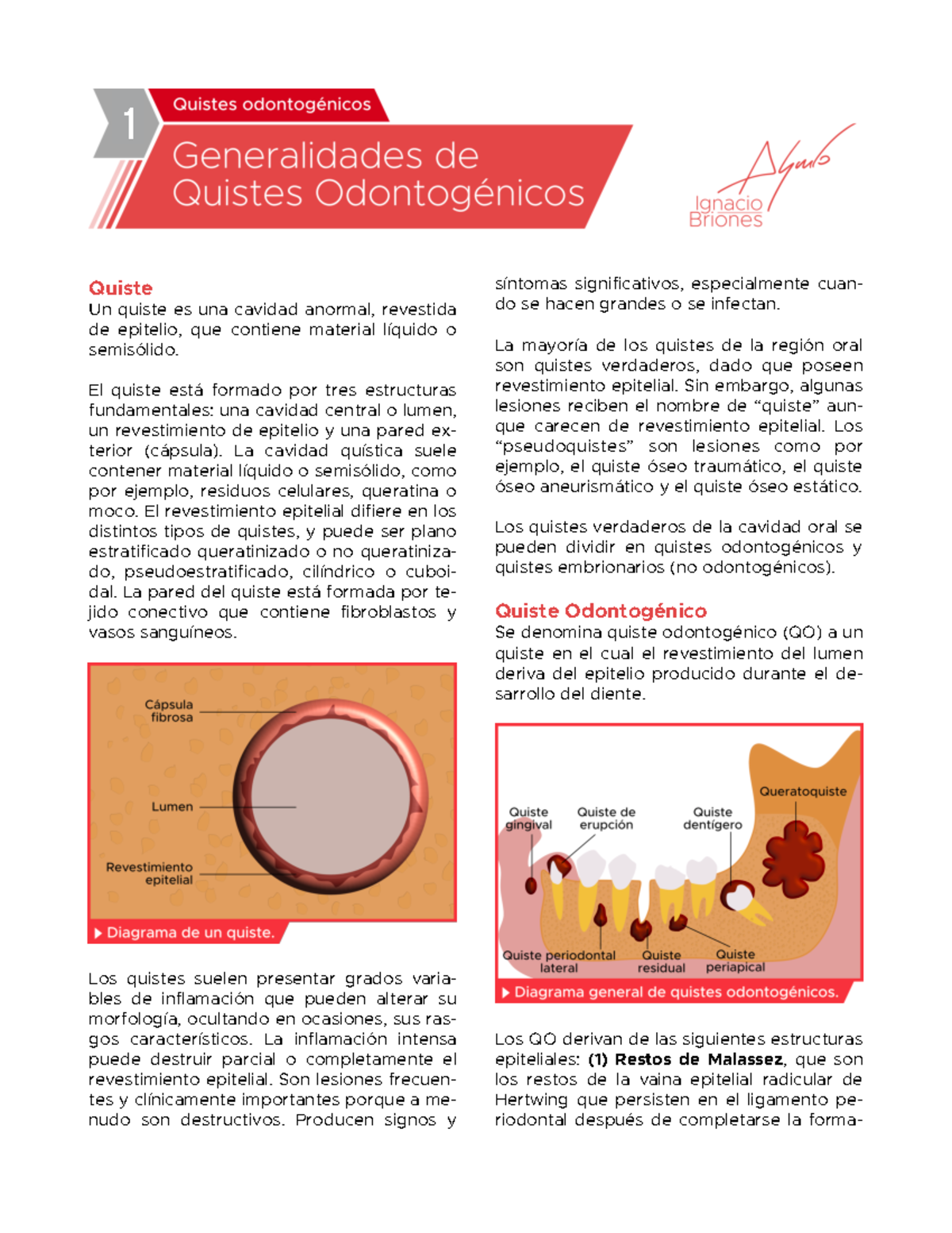 Generalidades de Quistes - Quiste Un quiste es una cavidad anormal ...