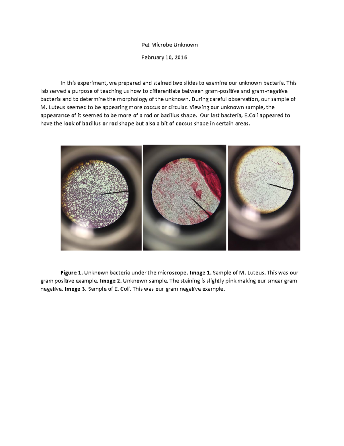 Group Lab Writeup 3 - Lab project - Pet Microbe Unknown February 10 ...