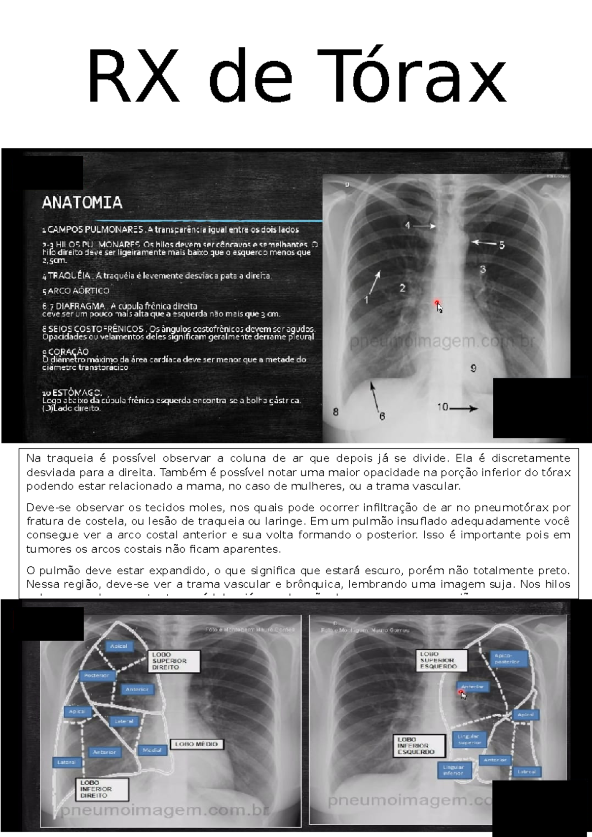 RX de Torax - RESUMO PRÁTICO FEITO PARA USO EM TUTORIAS E NO DIA A DIA ...