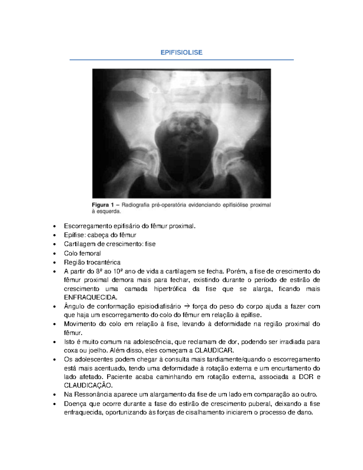 Epifisiolise - Resumo de Ortopedia completo - EPIFISIOLISE ...