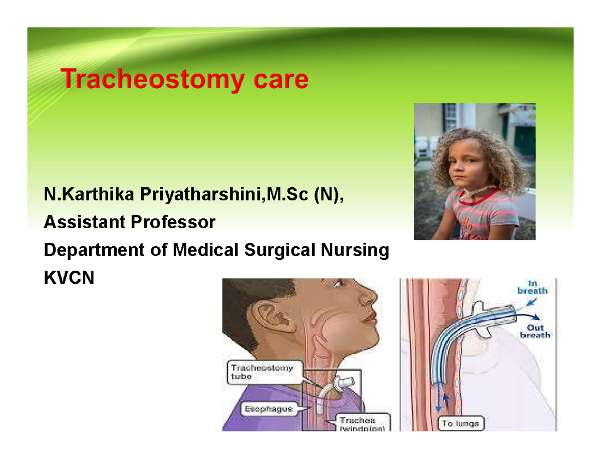 PPT- Tracheostomy-1 - shgdhsgs - N Priyatharshini,M (N), Assistant ...