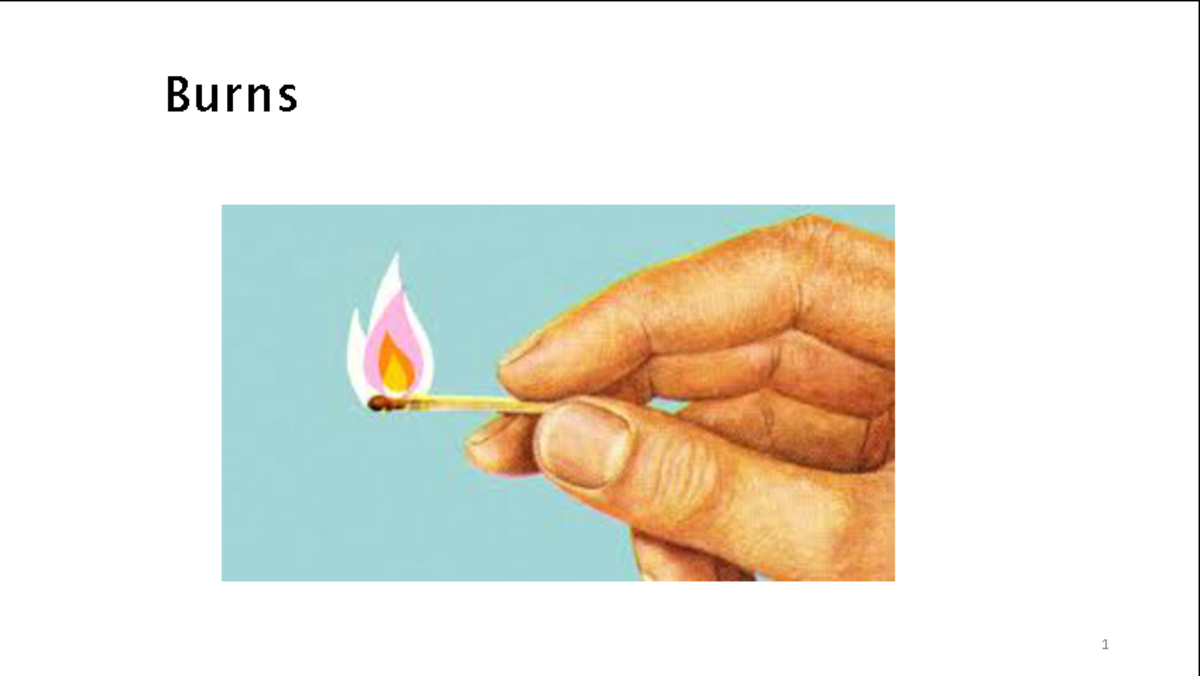 Critical Care Burns Lecture Notes 50+ Slides - Burns Classification of ...