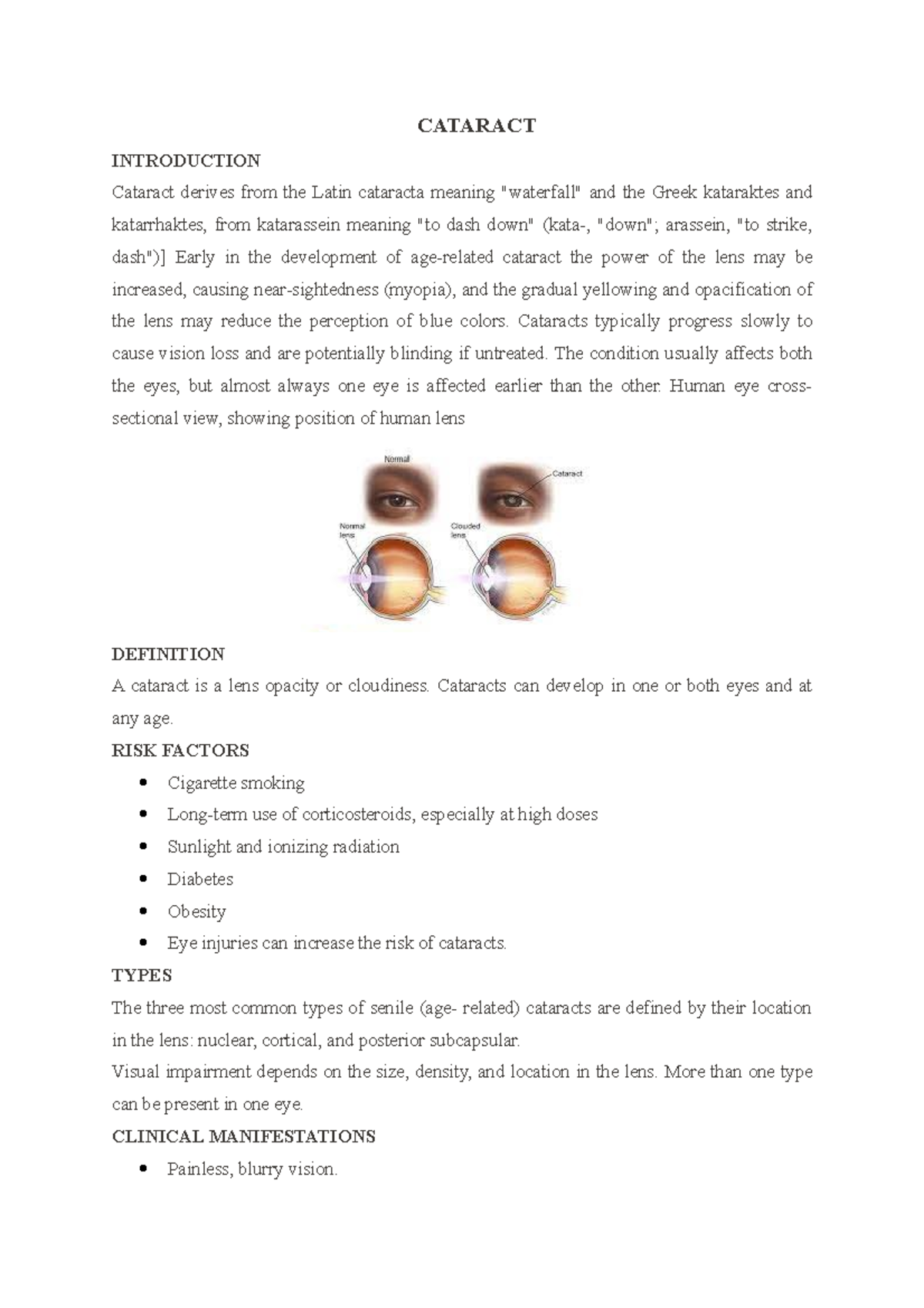 Cataract - jasmine ouseph - CATARACT INTRODUCTION Cataract derives from ...
