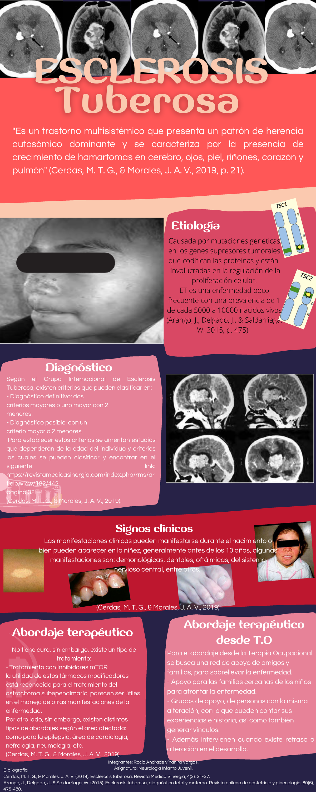 Infografía Esclerosis Tuberosa - Diagnóstico Según el Grupo ...