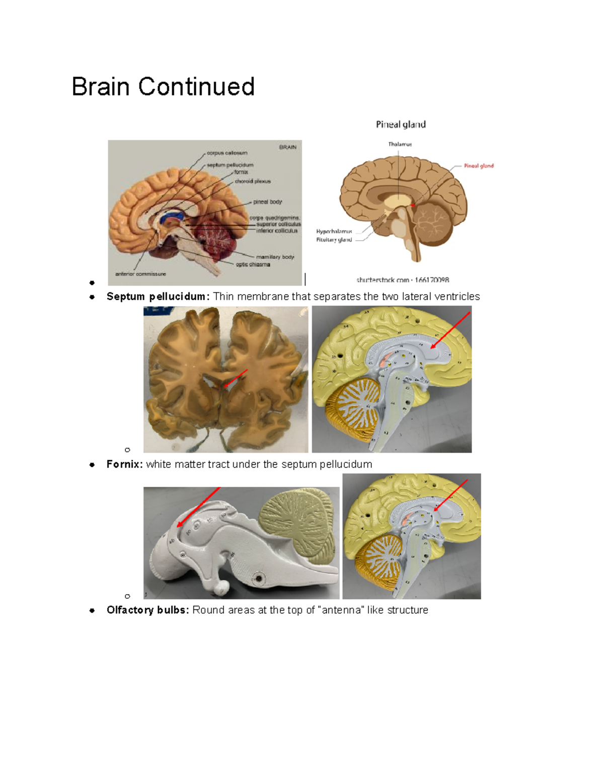 Lab Lecture 6 Brain and Cranial Nerves - Brain Continued Septum ...