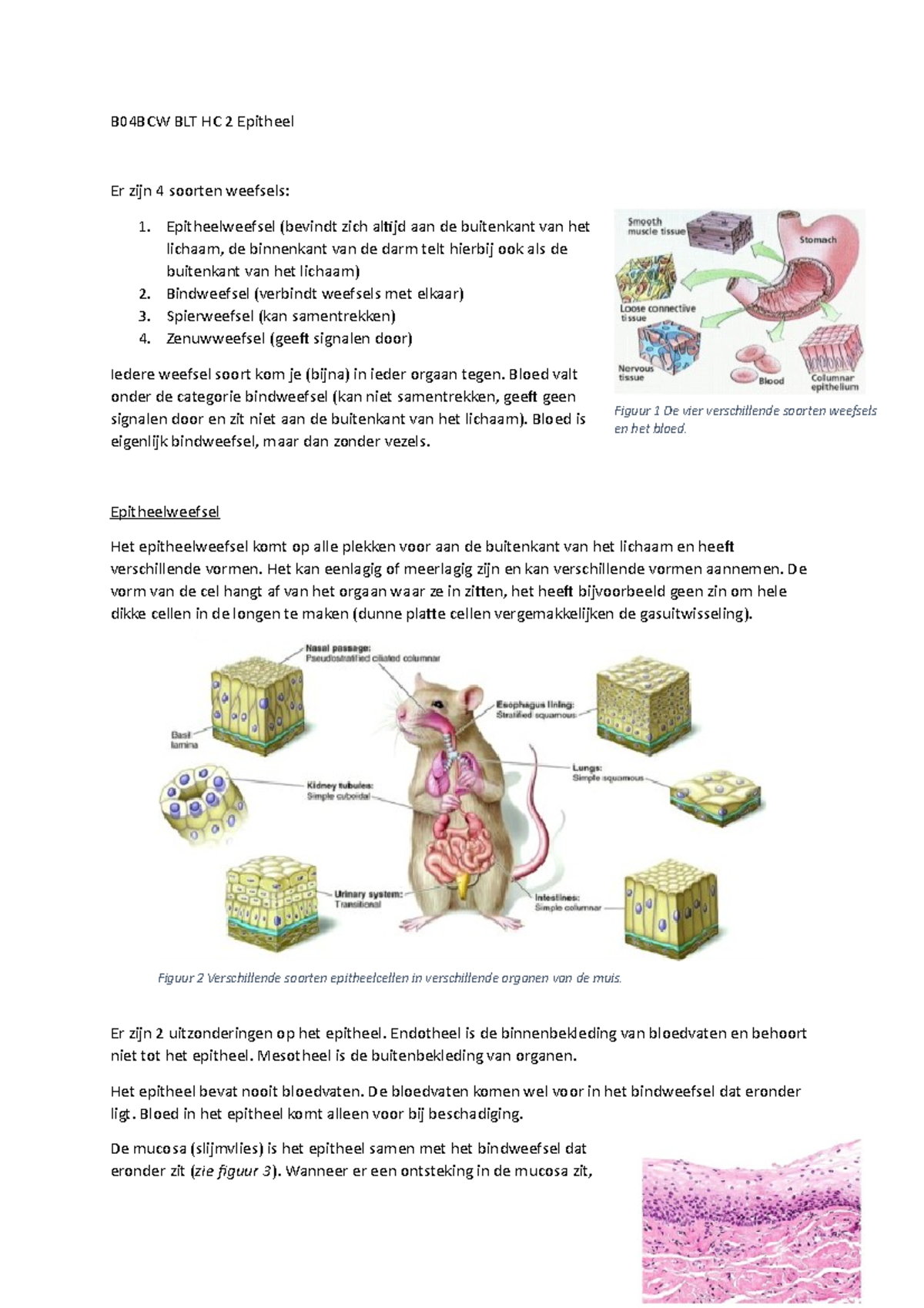 B04BCW BLT HC 2 Epitheel (AF) - B04BCW BLT HC 2 Epitheel Er zijn 4 ...