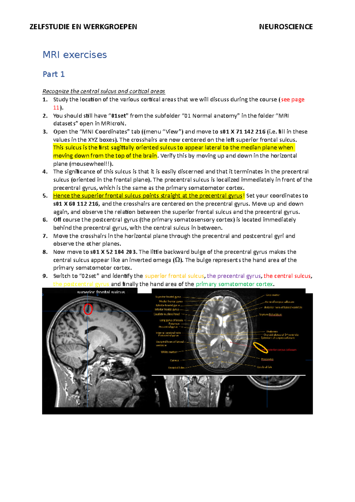 MRI exercises - MRI exercises Part 1 Recognize the central sulcus and ...